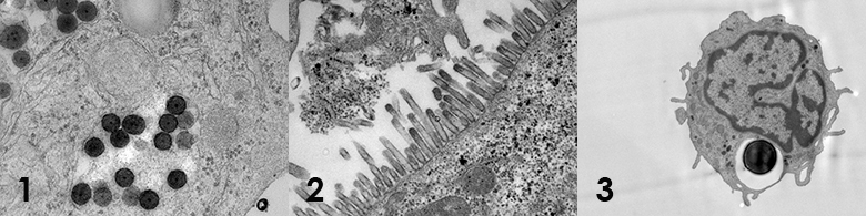 Electron Microscopy Core Facility Emil Our Offer Karolinska