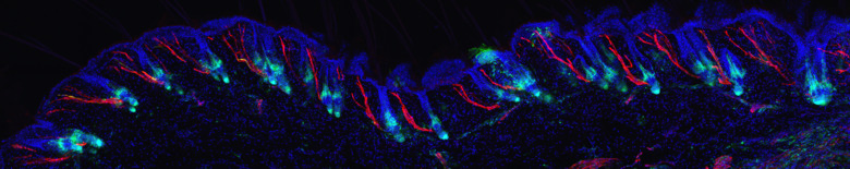 The Live Cell Imaging Core Facility | Karolinska Institutet